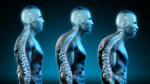 Postural Dysfunction | Deepdene Chiropractic & Myotherapy Clinic